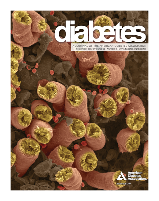Rab8a Deficiency in Skeletal Muscle Causes Hyperlipidemia and ... Rab8a Deficiency in Skeletal Muscle Causes Hyperlipidemia and ...