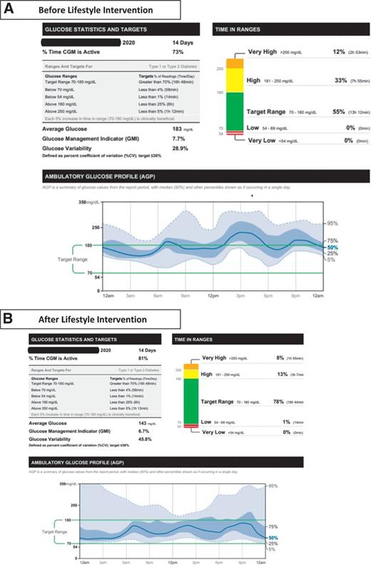 Beyond A1C—Standardization of Continuous Glucose Monitoring Reporting ...