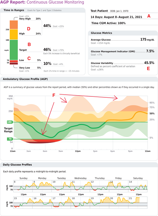 Remote Patient Monitoring in Diabetes: How to Acquire, Manage, and Use ...